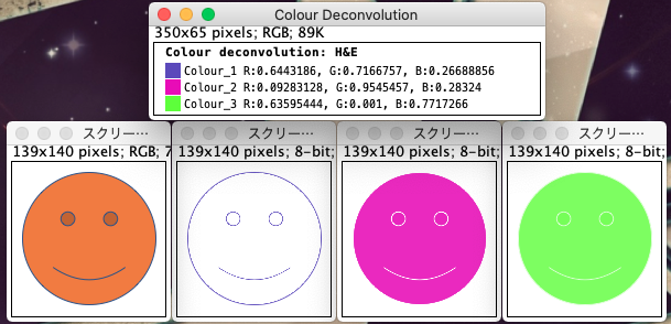 ImageJで染色画像から目的の色を抽出！Colour Deconvolution: とりがらの研究ライフハック